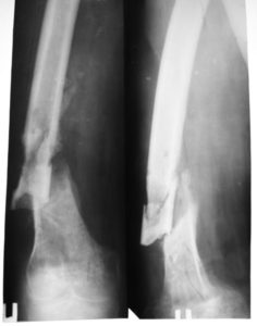 Blog of the clinic of modern orthopedics and traumatology Ladisten